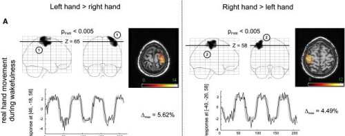 Scientists record lucid dreams with EEG and fMRI simultaneously | Neuroamer